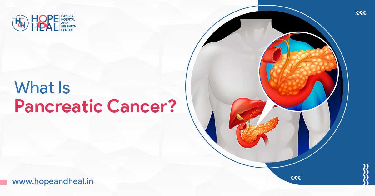 Knowing Pancreatic Cancer Signs Prevention And Medical Care